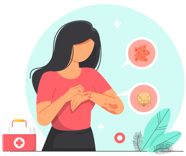 La gale : symptômes, durée, causes... comprendre la maladie