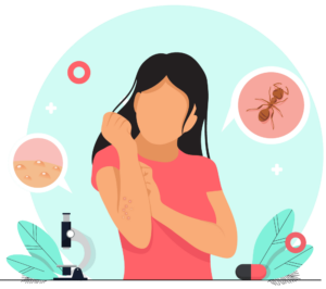 Piqûre de fourmi : rouge, noire, volante ,... comment la reconnaitre